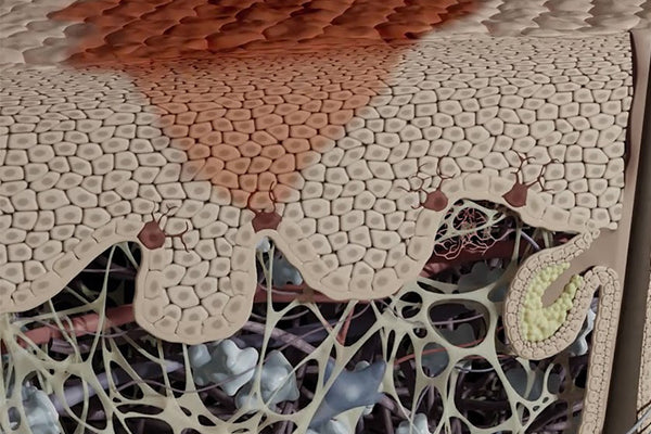 Tout savoir sur l'hyperpigmentation et les taches brunes sur la peau ...